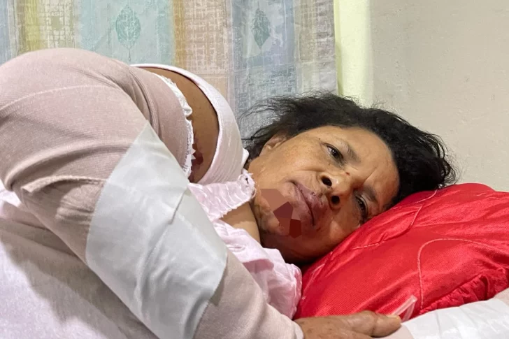 Hospitalizan mujer que fue atacada por perros pitbull en barrio de Santiago | Acento