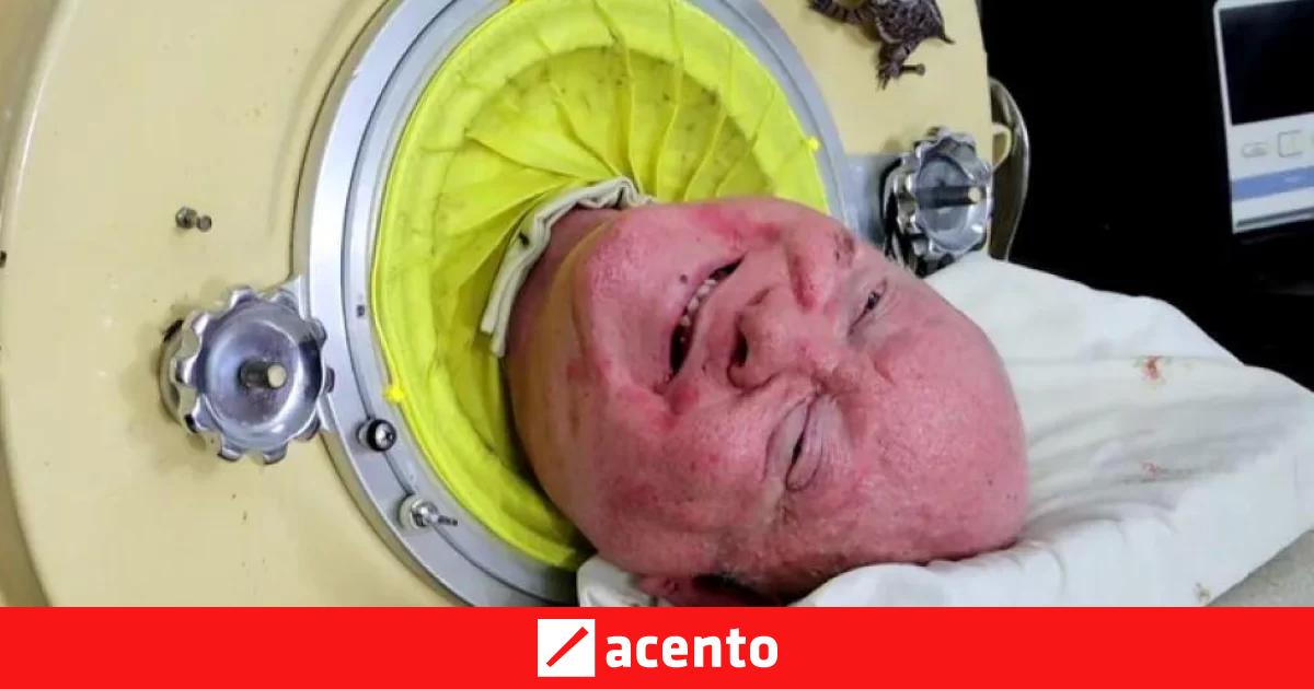 Muere a los 78 años 'el hombre del pulmón de acero' Paul Alexander | Acento